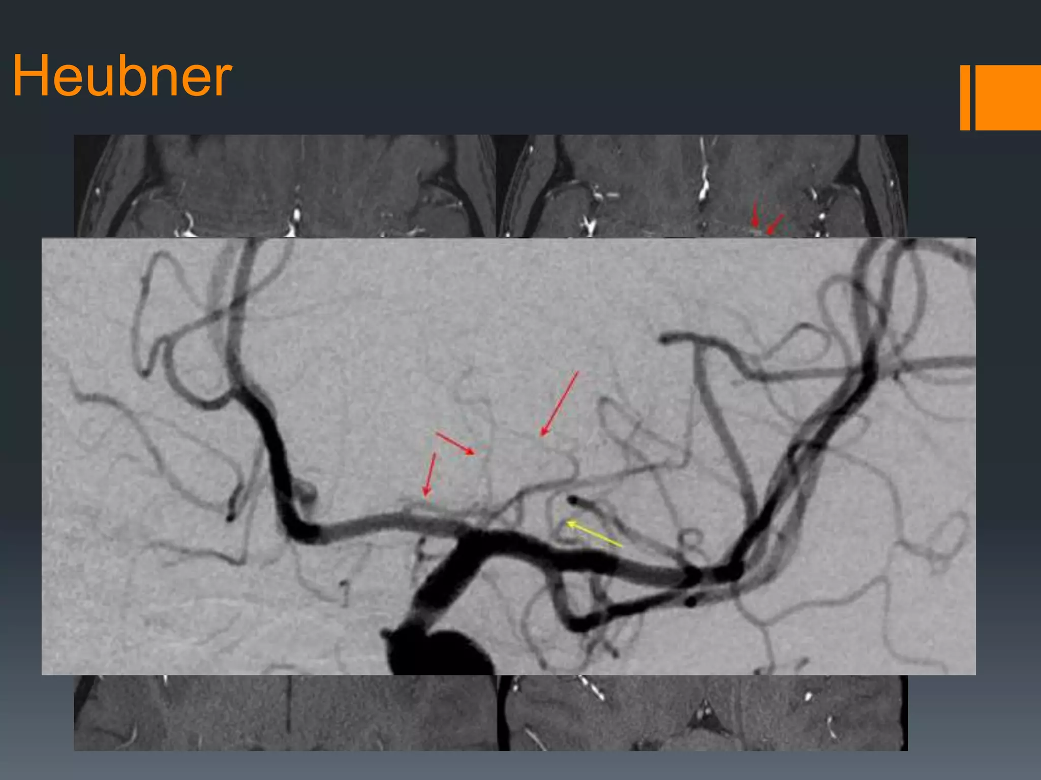Neurovascular anatomy | PPTX