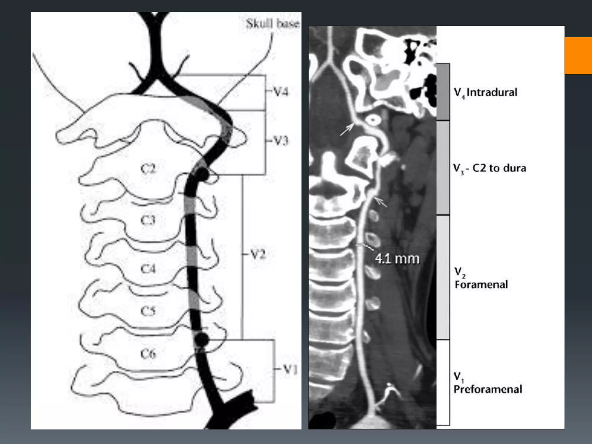 Neurovascular anatomy | PPTX