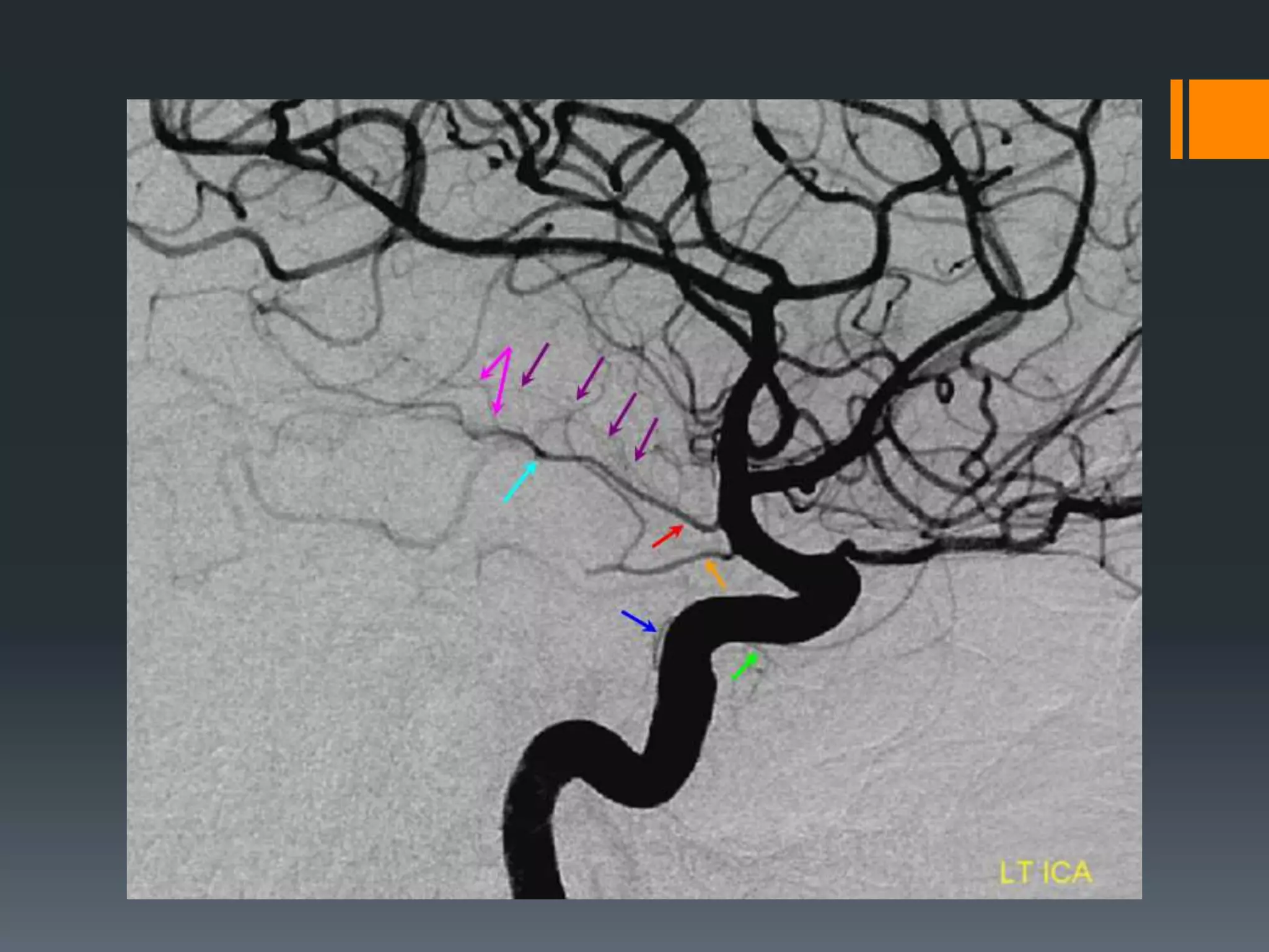 Neurovascular anatomy | PPTX