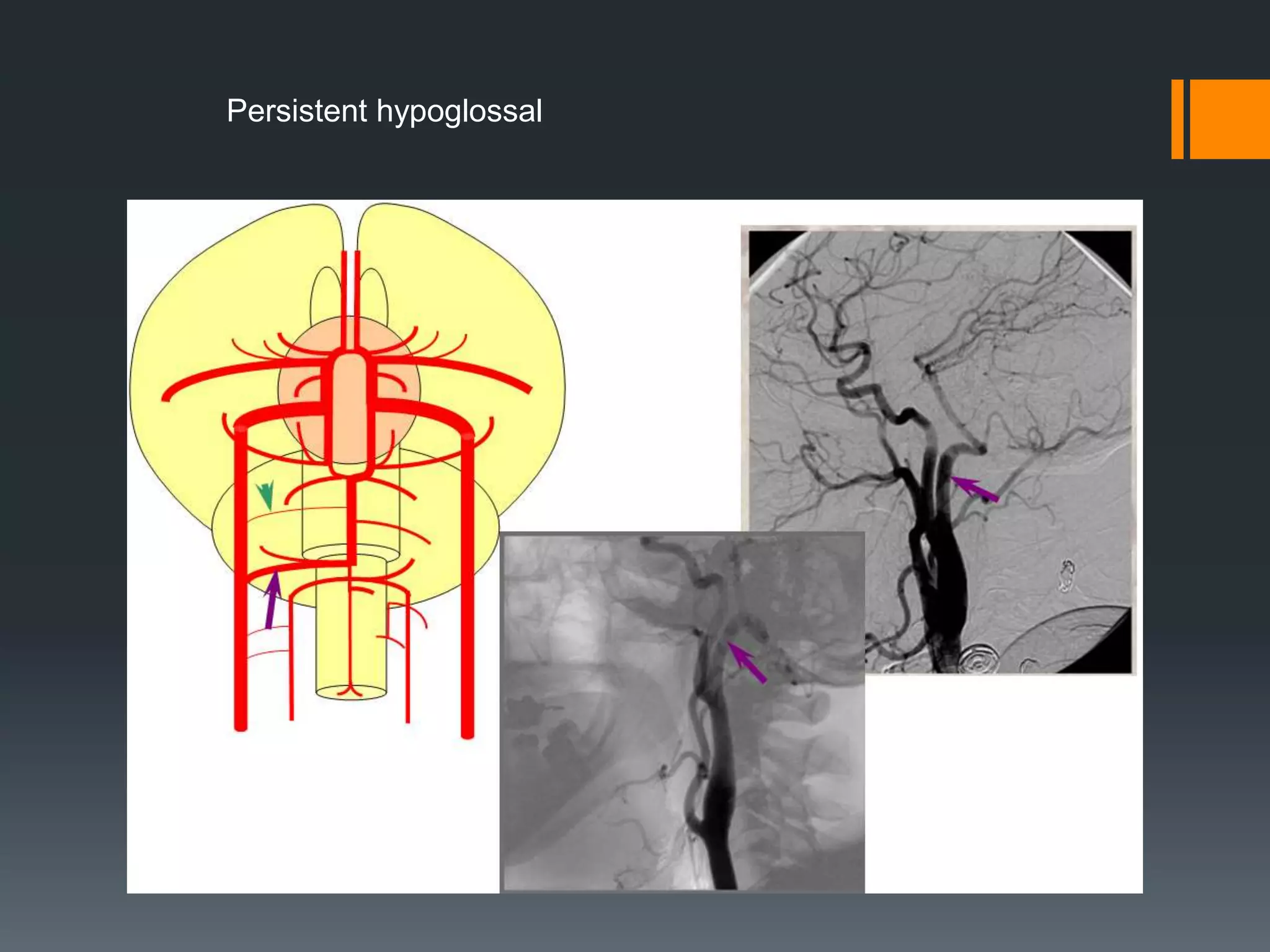 Neurovascular anatomy | PPTX