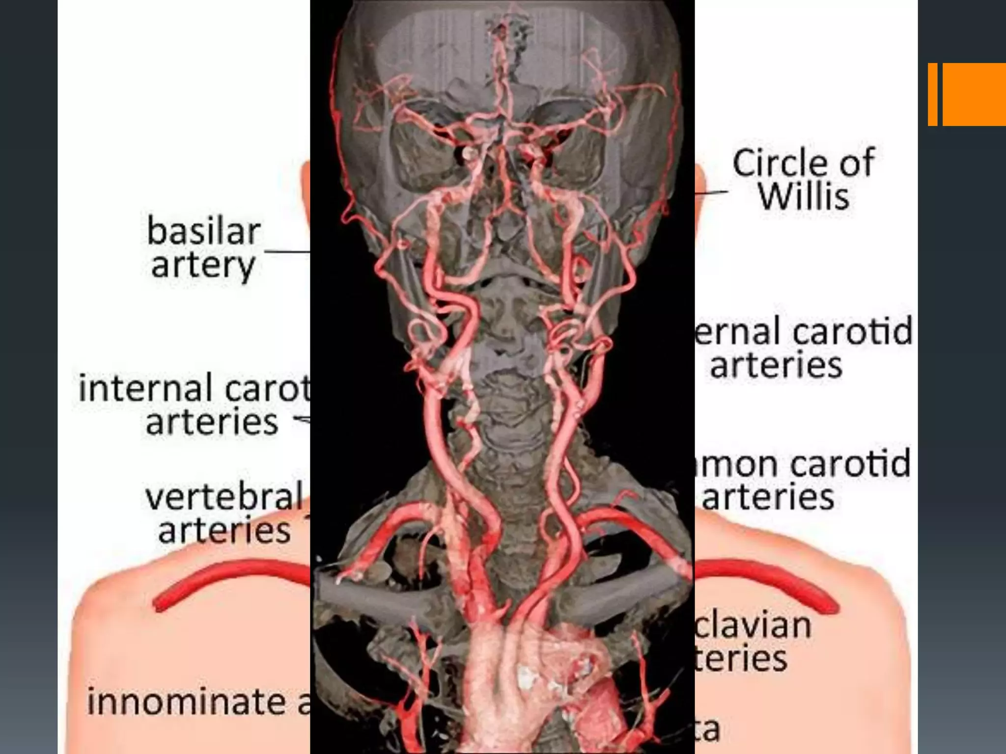 Neurovascular anatomy | PPTX