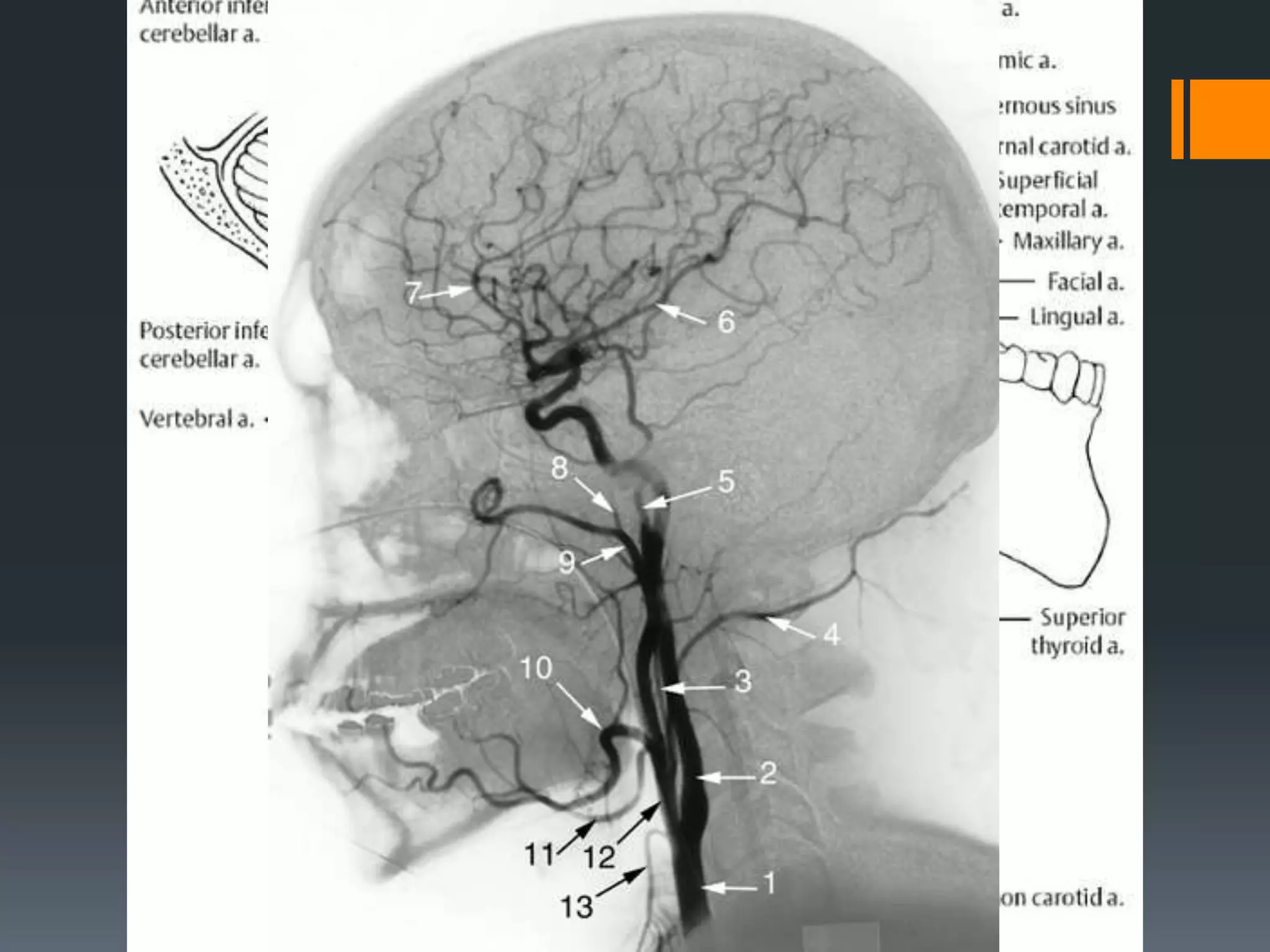 Neurovascular anatomy | PPTX