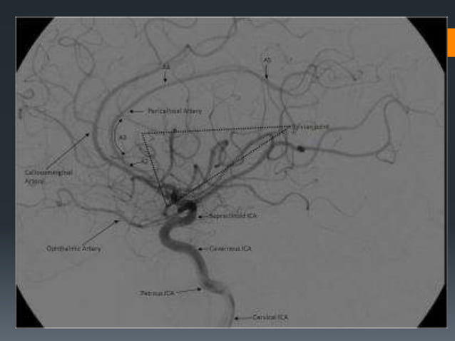 Neurovascular anatomy | PPTX | Brain and Nervous System Disorders ...