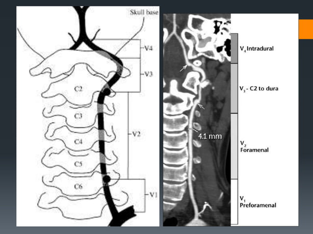 Neurovascular anatomy | PPTX | Brain and Nervous System Disorders ...
