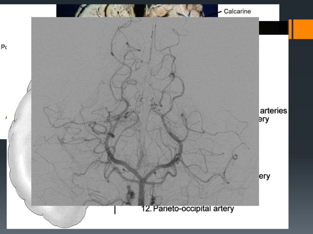 Neurovascular anatomy | PPTX | Brain and Nervous System Disorders ...