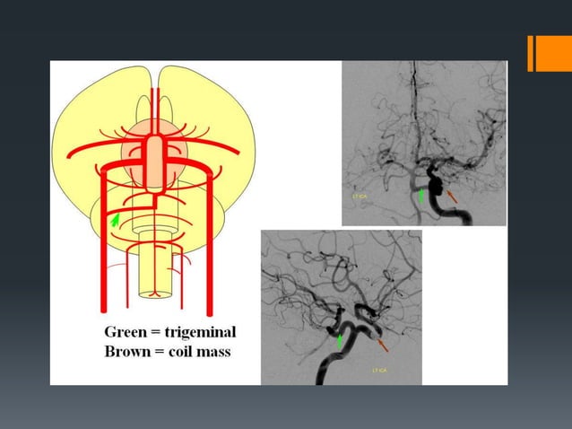 Neurovascular anatomy | PPTX | Brain and Nervous System Disorders ...