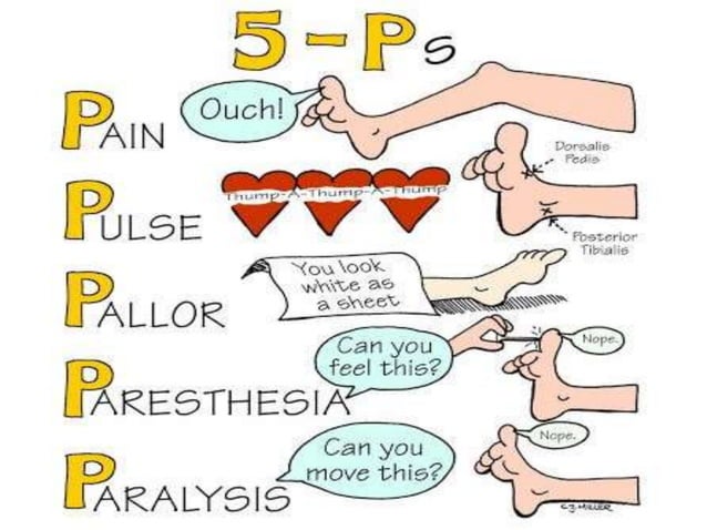 Neurovascular assessment | PPTX | First Aid | Injuries