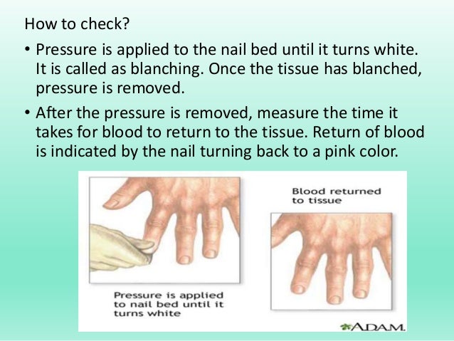 Neurovascular assessment