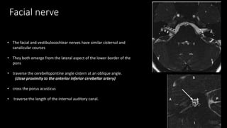 Neurovascular compression syndromes.pptx