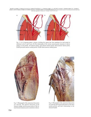 Neurovascular structures at risk during anterolateral and medial ...