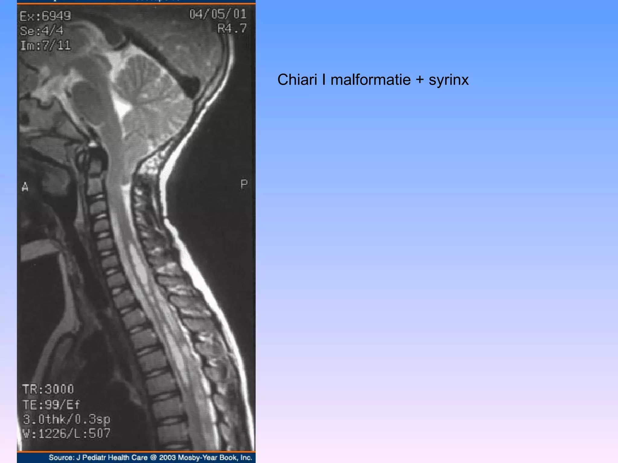 Neurovragen vgt voorjaar 2010 | PPT
