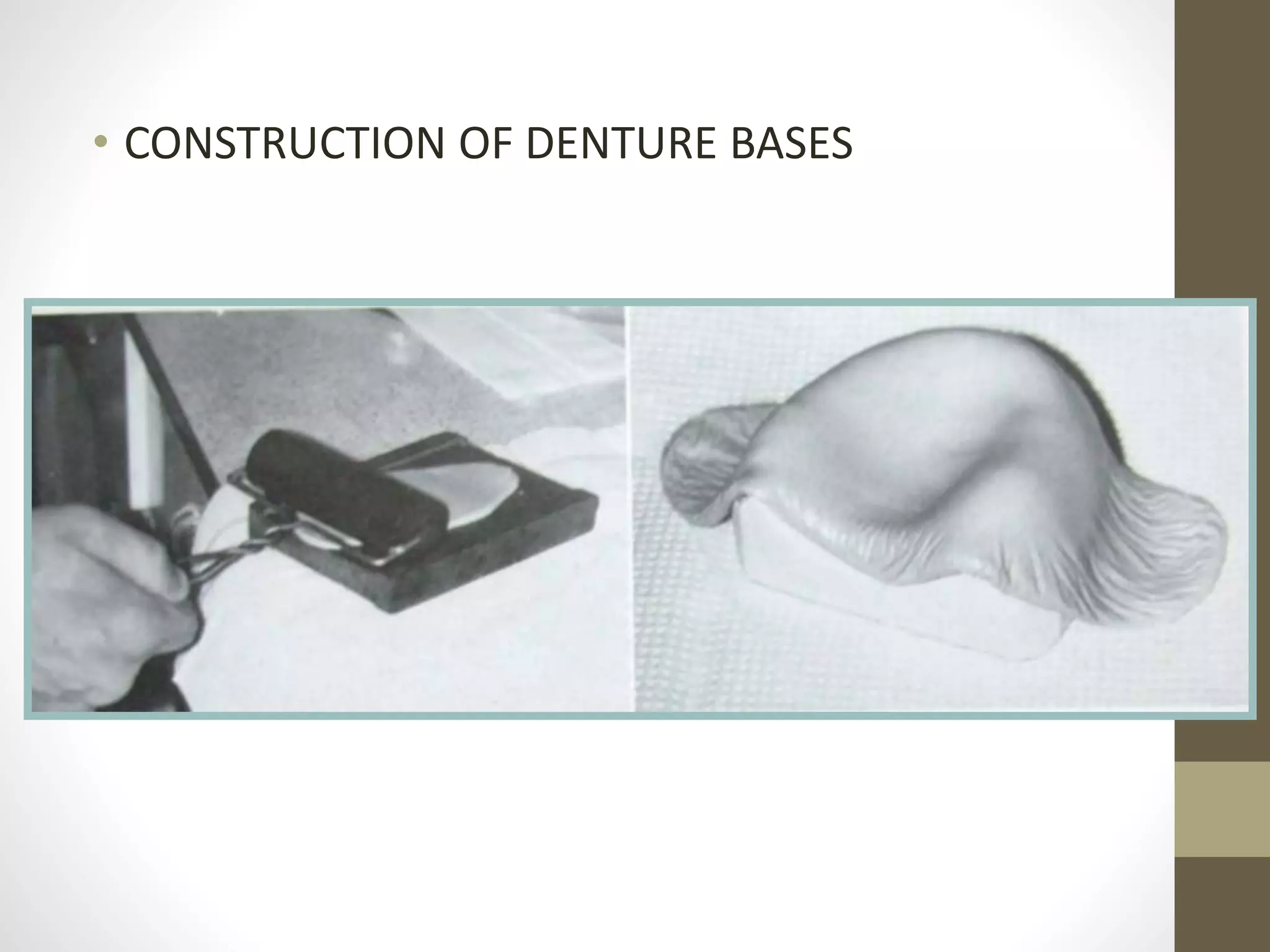 Neutral zone in complete dentures | PPTX