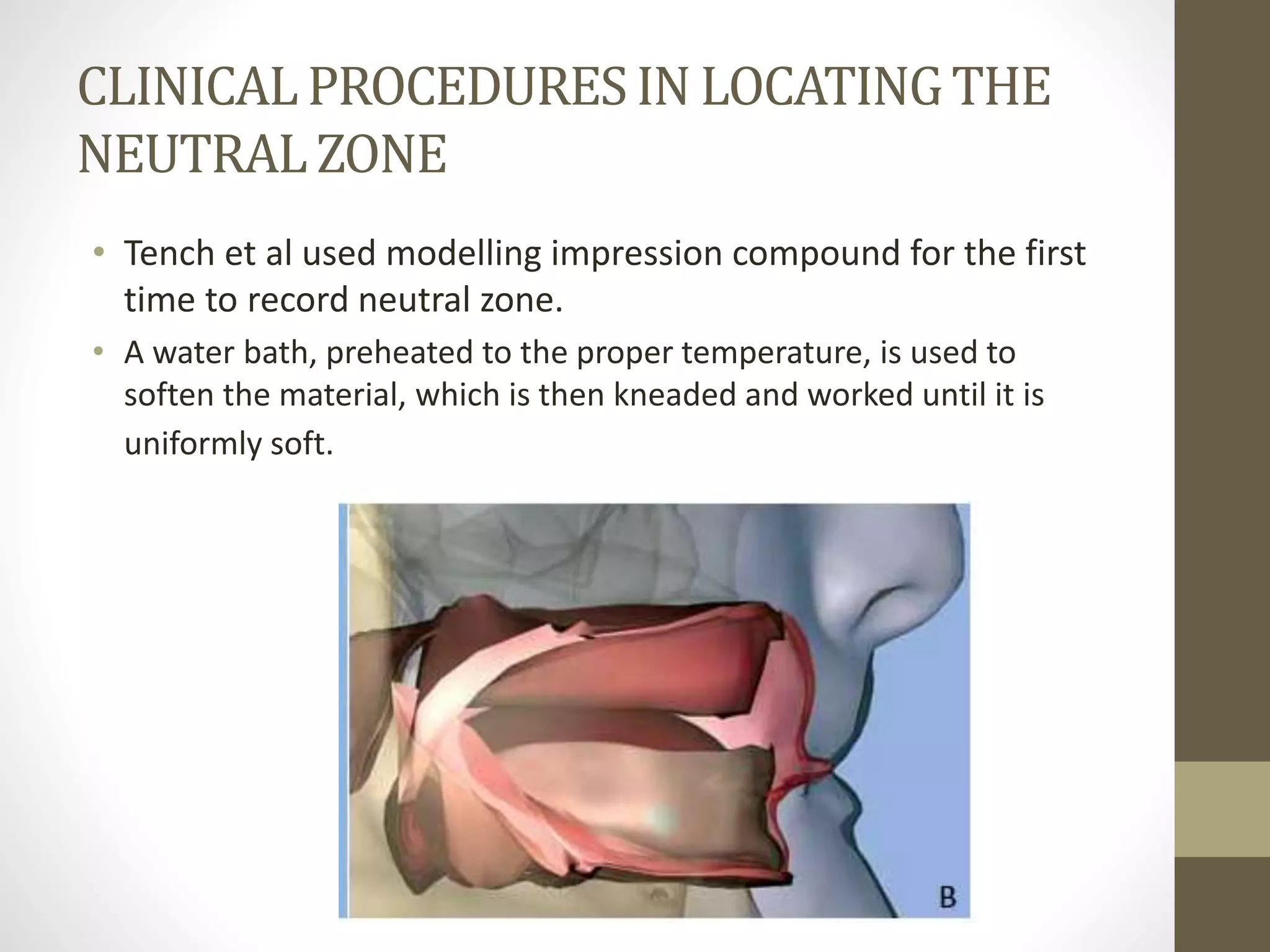 Neutral zone in complete dentures | PPTX