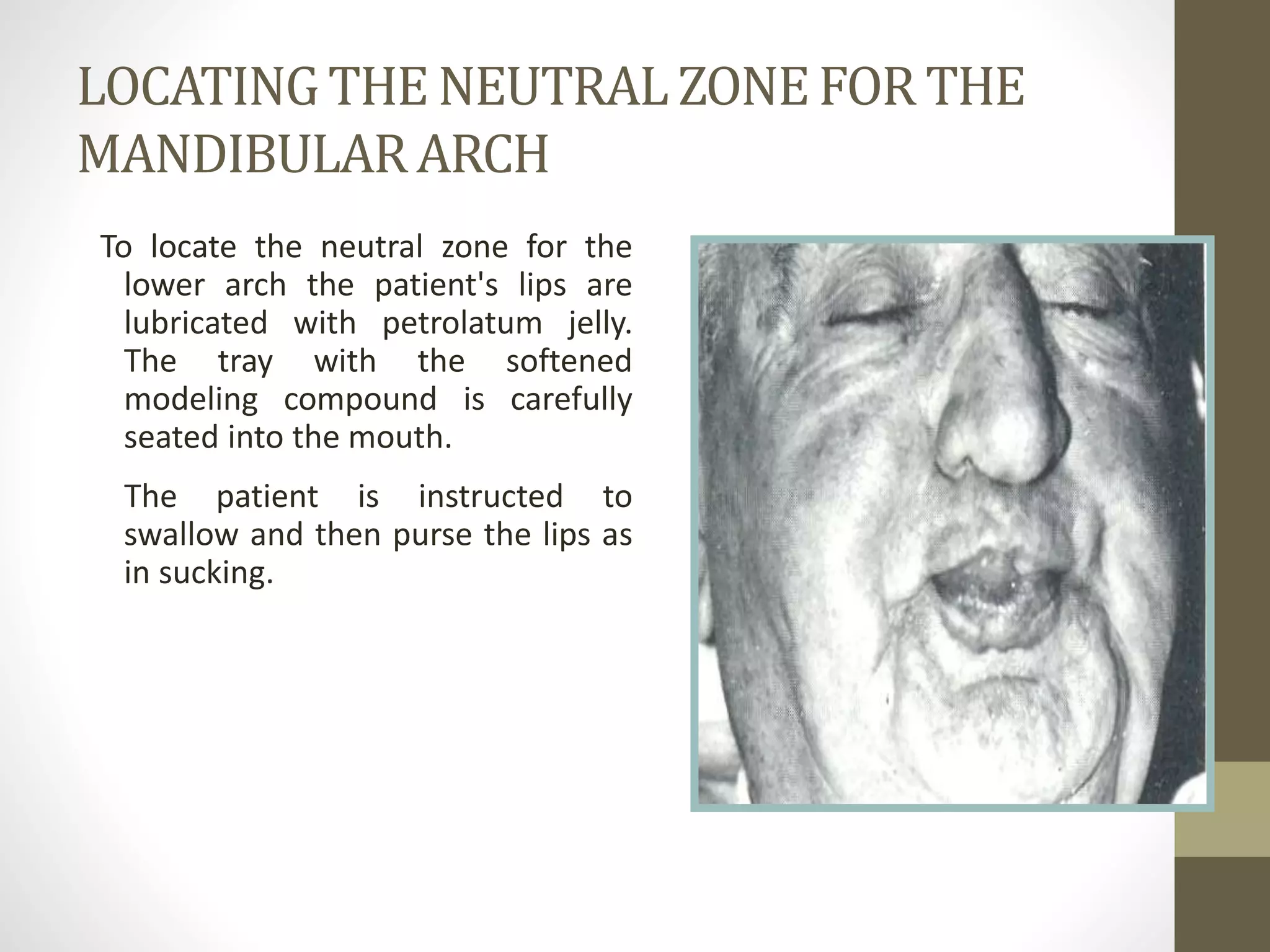 Neutral zone in complete dentures | PPTX