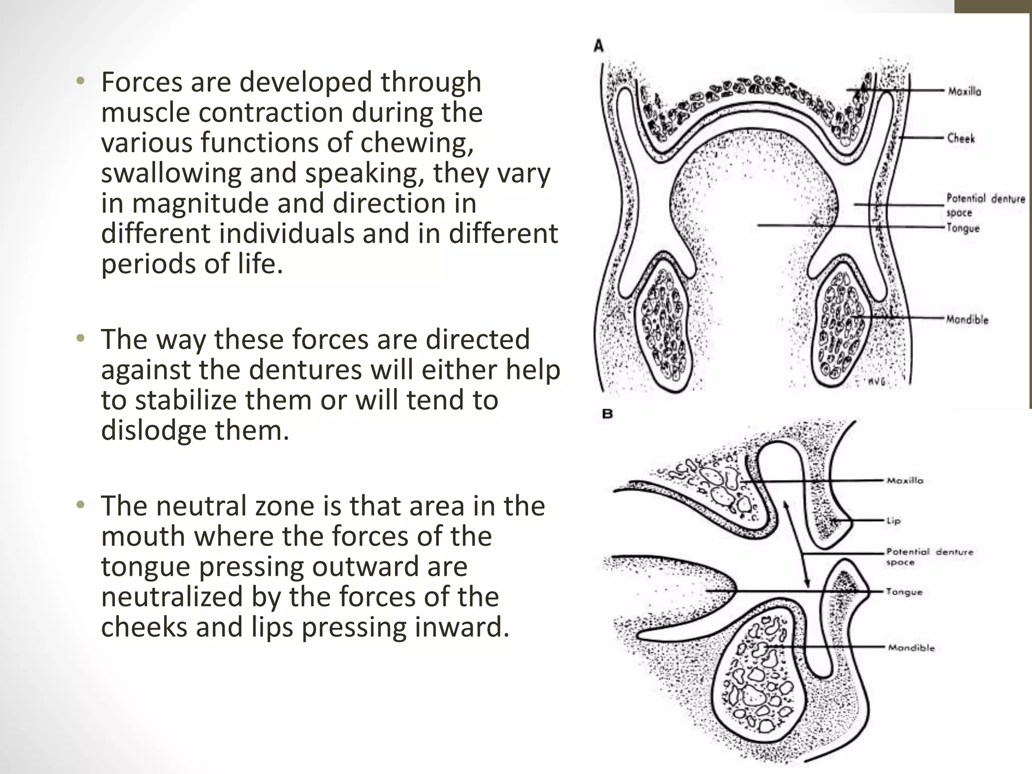 Neutral zone in complete dentures | PPTX