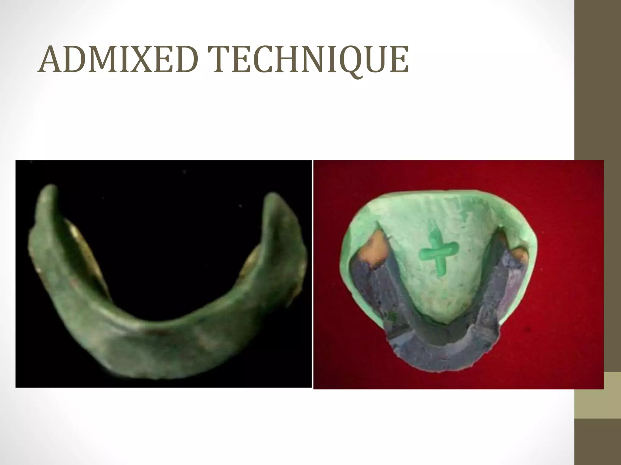 Neutral zone in complete dentures | PPTX