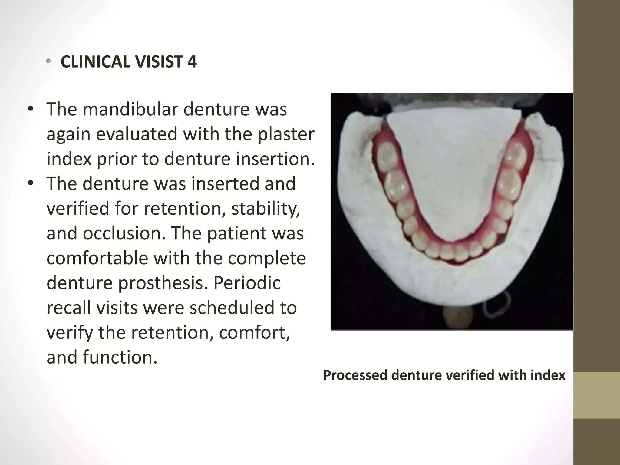 Neutral zone in complete dentures | PPTX