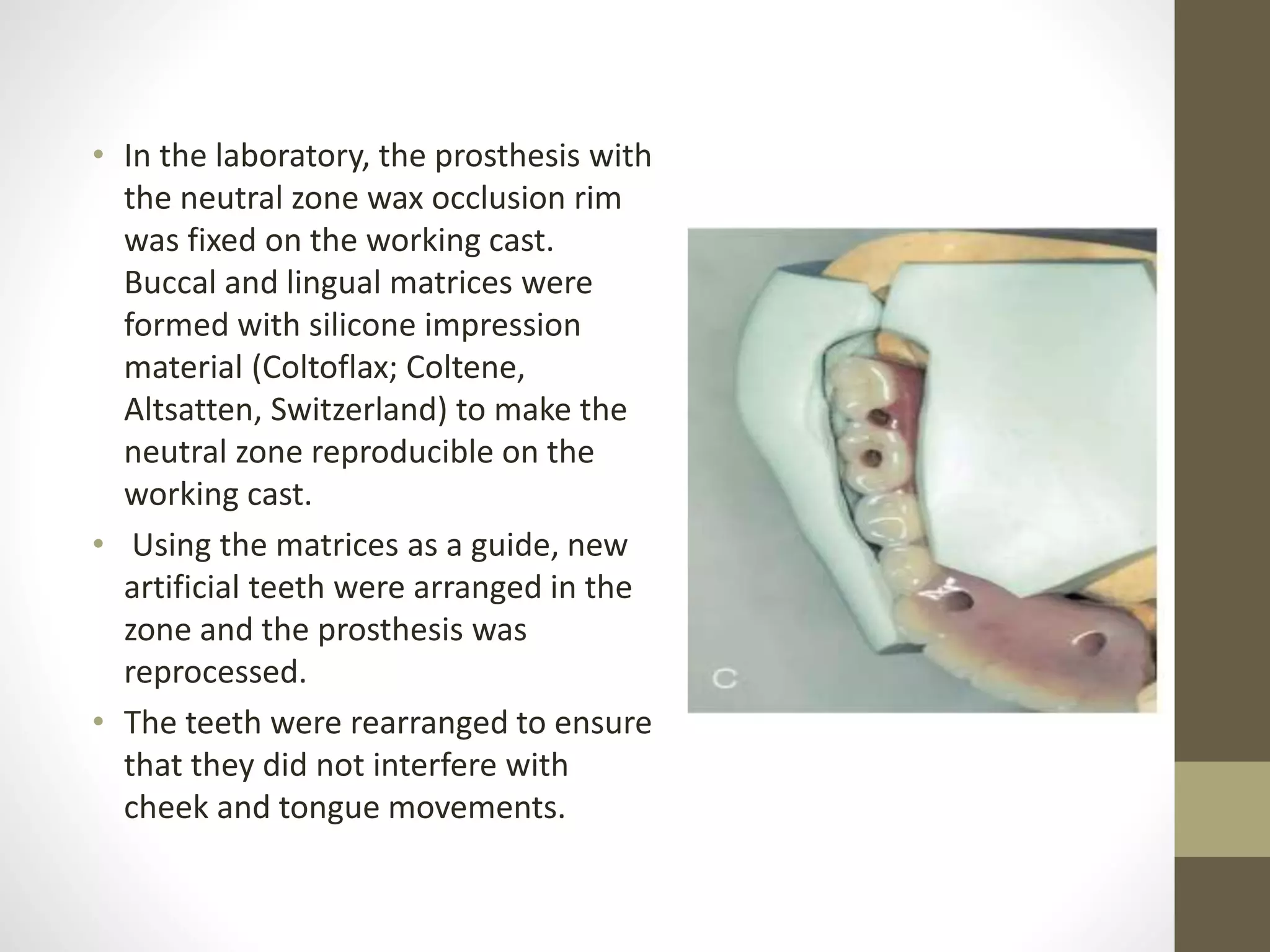 Neutral zone in complete dentures | PPTX