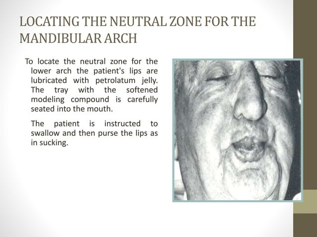 Neutral zone in complete dentures | PPTX | Dental Health | Diseases and ...