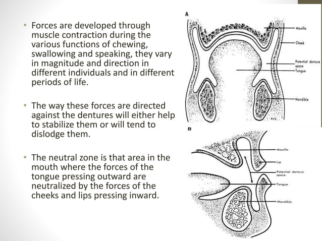 Neutral zone in complete dentures | PPTX | Dental Health | Diseases and ...