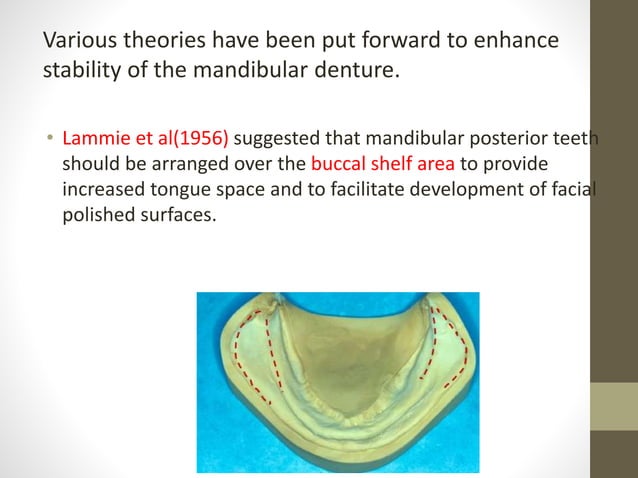 Neutral zone in complete dentures | PPTX | Dental Health | Diseases and ...