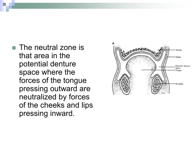 Neutral zone concept in complte dentures.ppt | Oral care | Personal Care