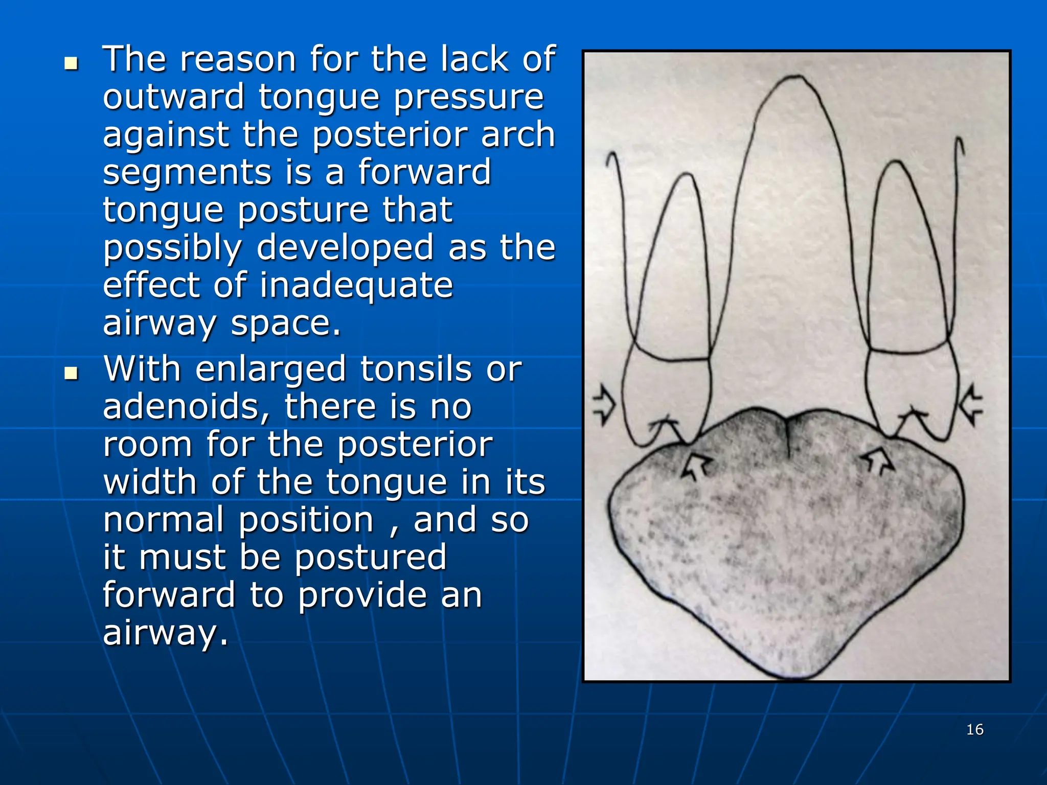 Neutral Zone In Prosthodontics part 1.ppt