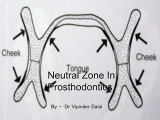 Neutral Zone In Prosthodontics part 1.ppt