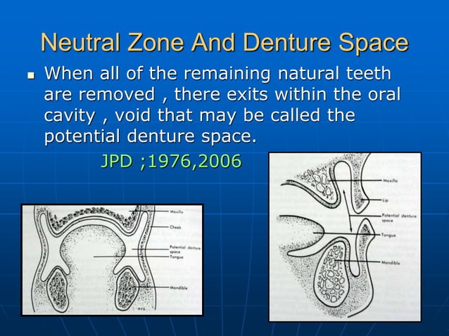 Neutral Zone In Prosthodontics part 1.ppt | Ear, Nose and Throat ...