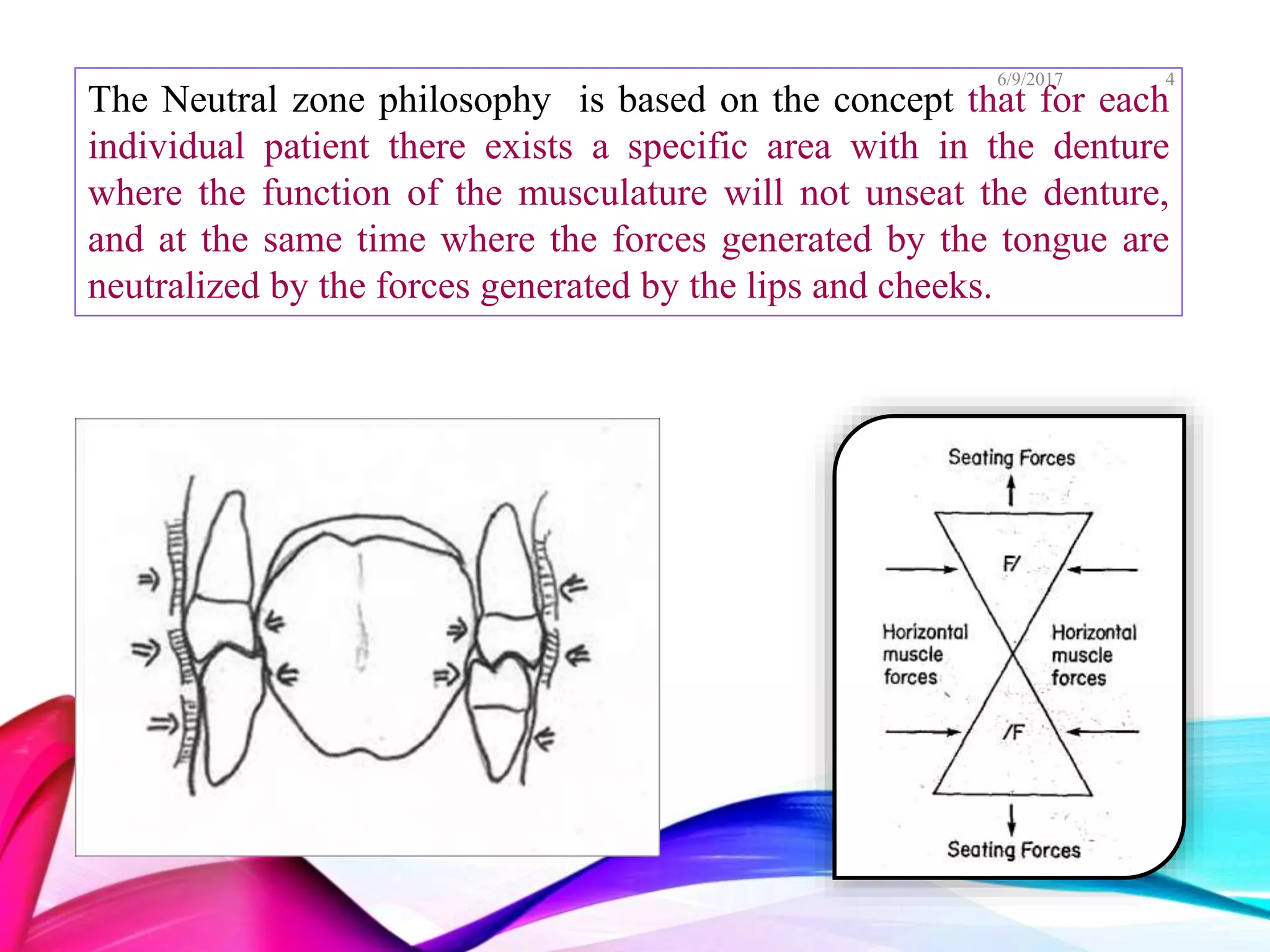 Neutral zone technique Journal club presentation | PPTX