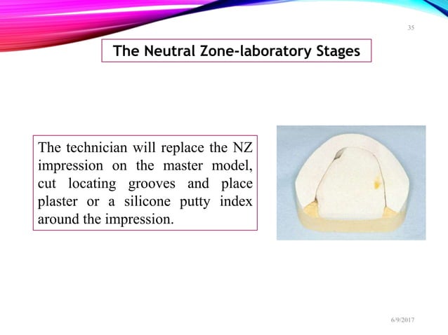 Neutral zone technique Journal club presentation | PPTX