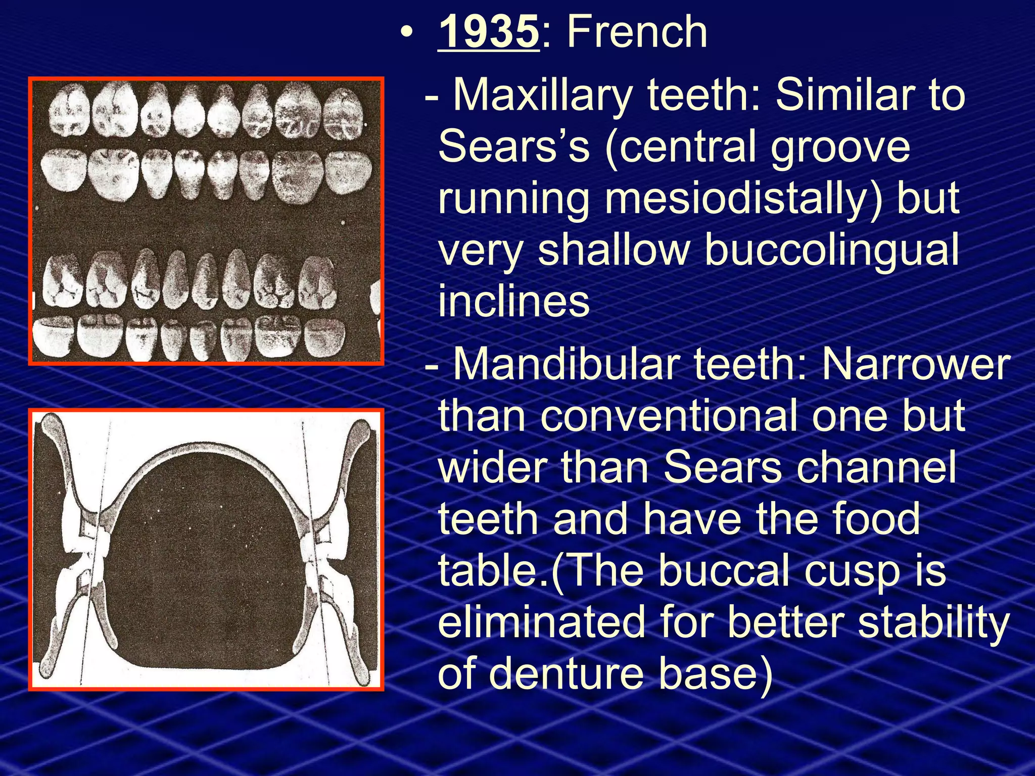 Neutrocentric Concept (prosthodontics) | PPT