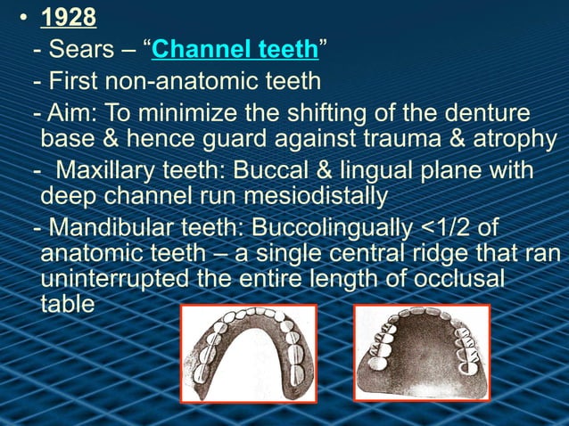 Neutrocentric Concept (prosthodontics) | PPT | Dental Health | Diseases ...