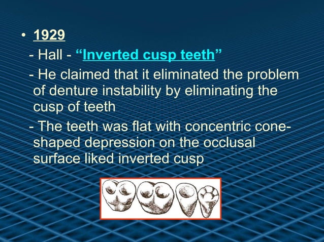 Neutrocentric Concept (prosthodontics) | PPT | Dental Health | Diseases ...