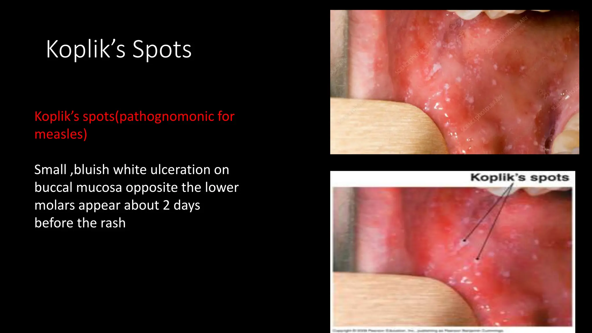 neutrophic viruses Microbiology subject.pptx