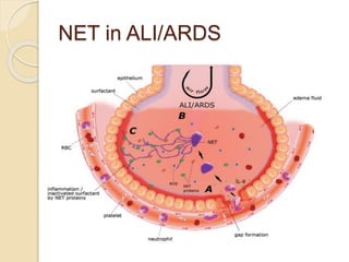 Neutrophil extracellular trap | PPTX