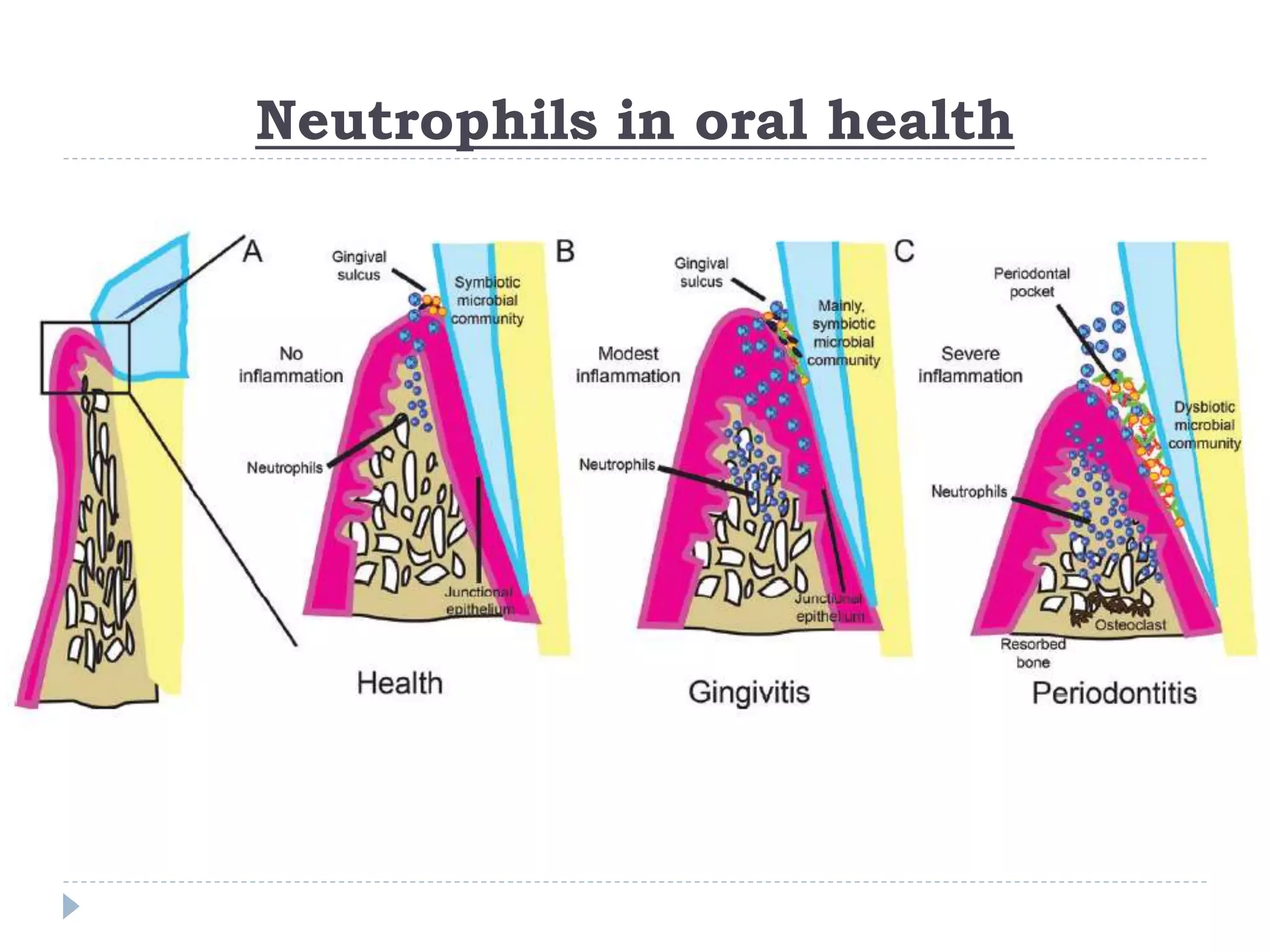 Neutrophils in periodontics | PPTX