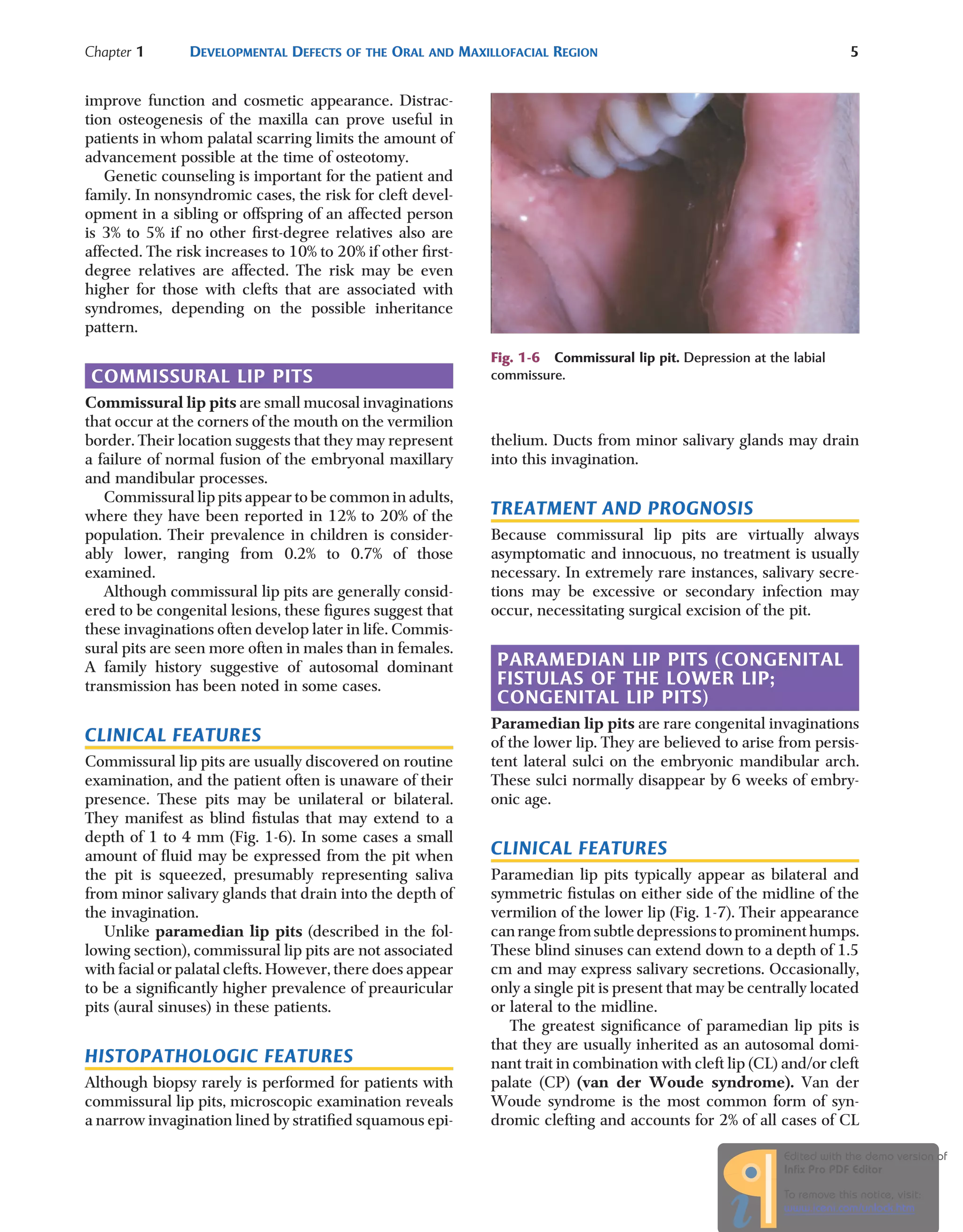 Neville, Oral and Maxillofacial Pathology, 3e.pdf