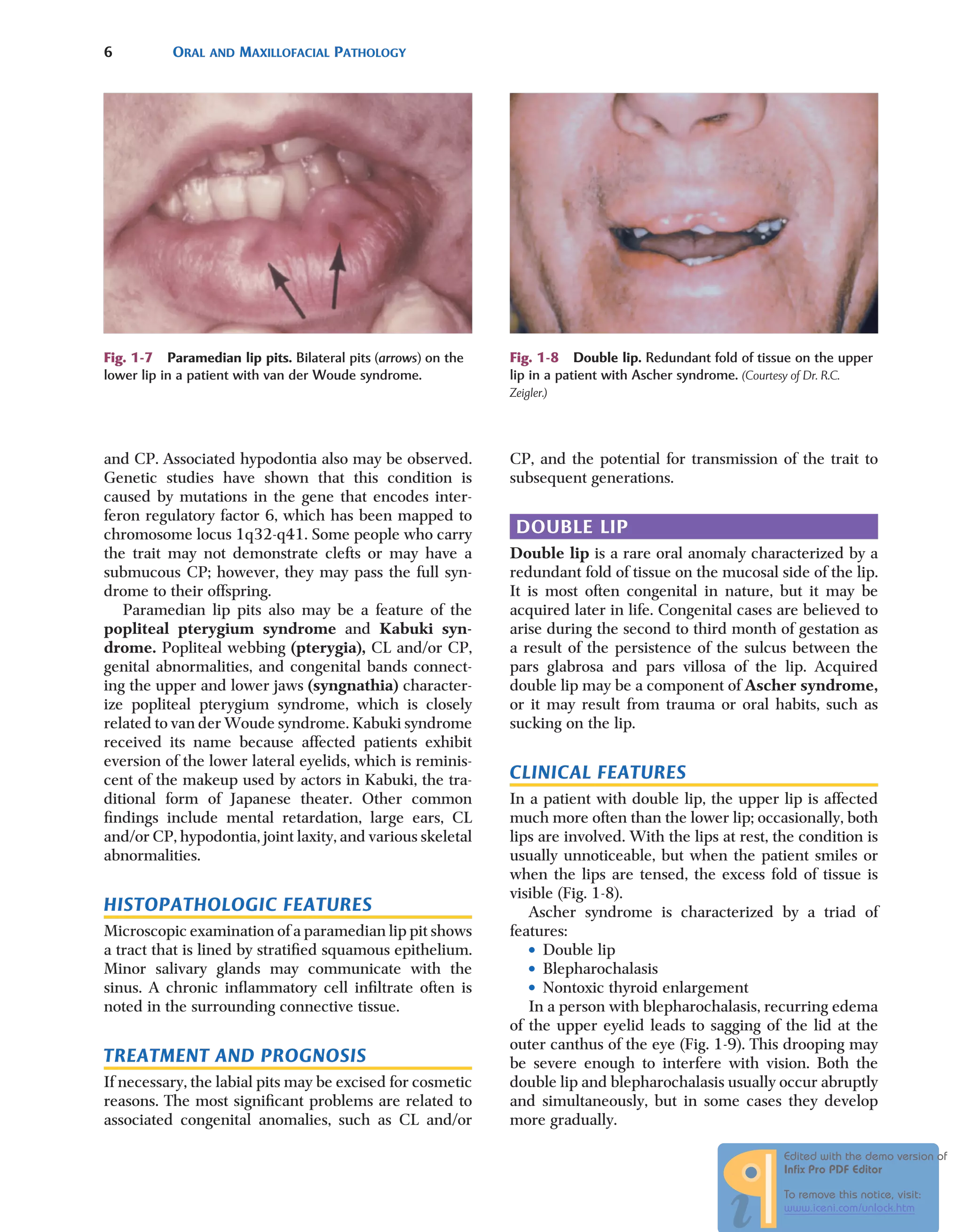 Neville, Oral and Maxillofacial Pathology, 3e.pdf