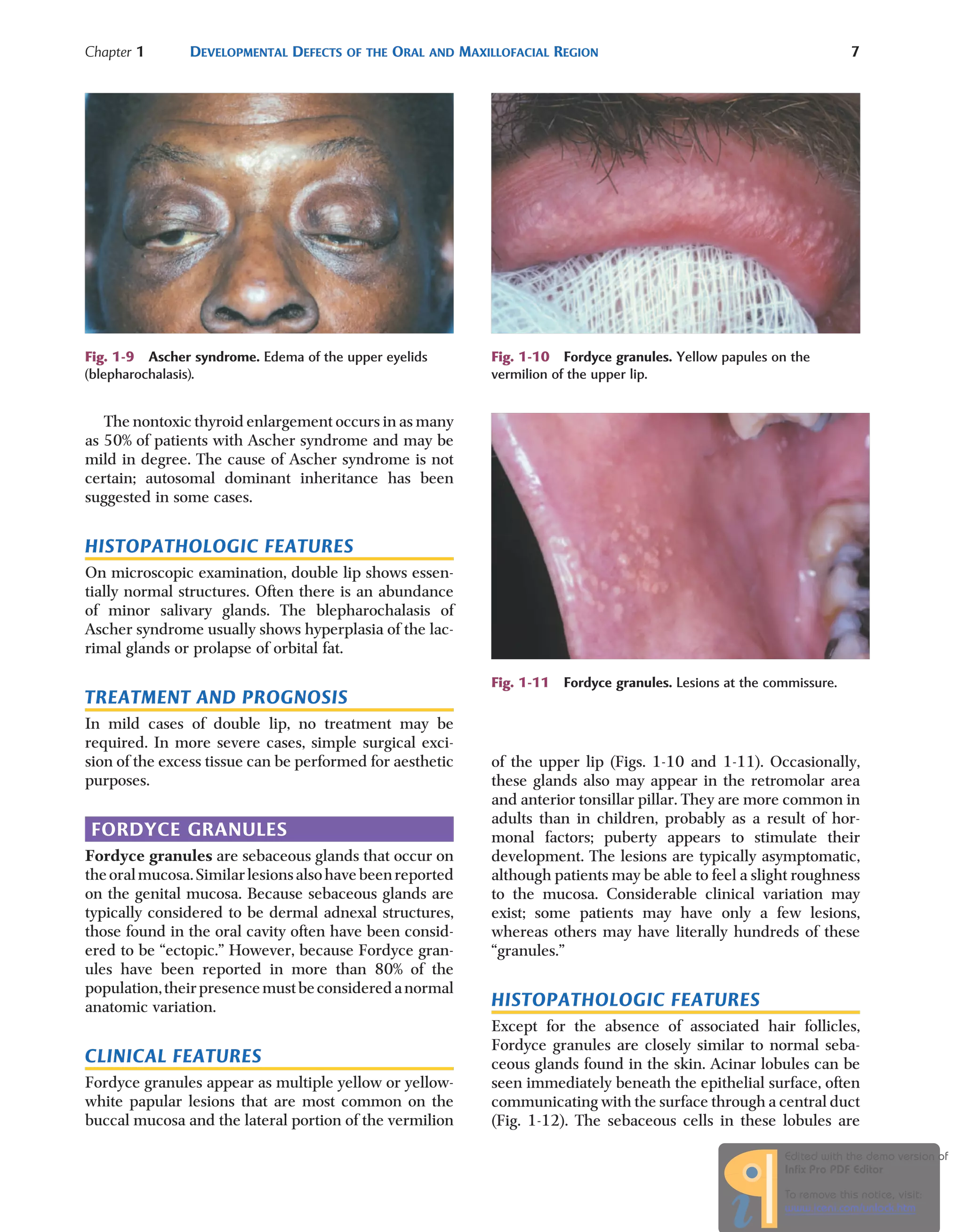 Neville, Oral and Maxillofacial Pathology, 3e.pdf