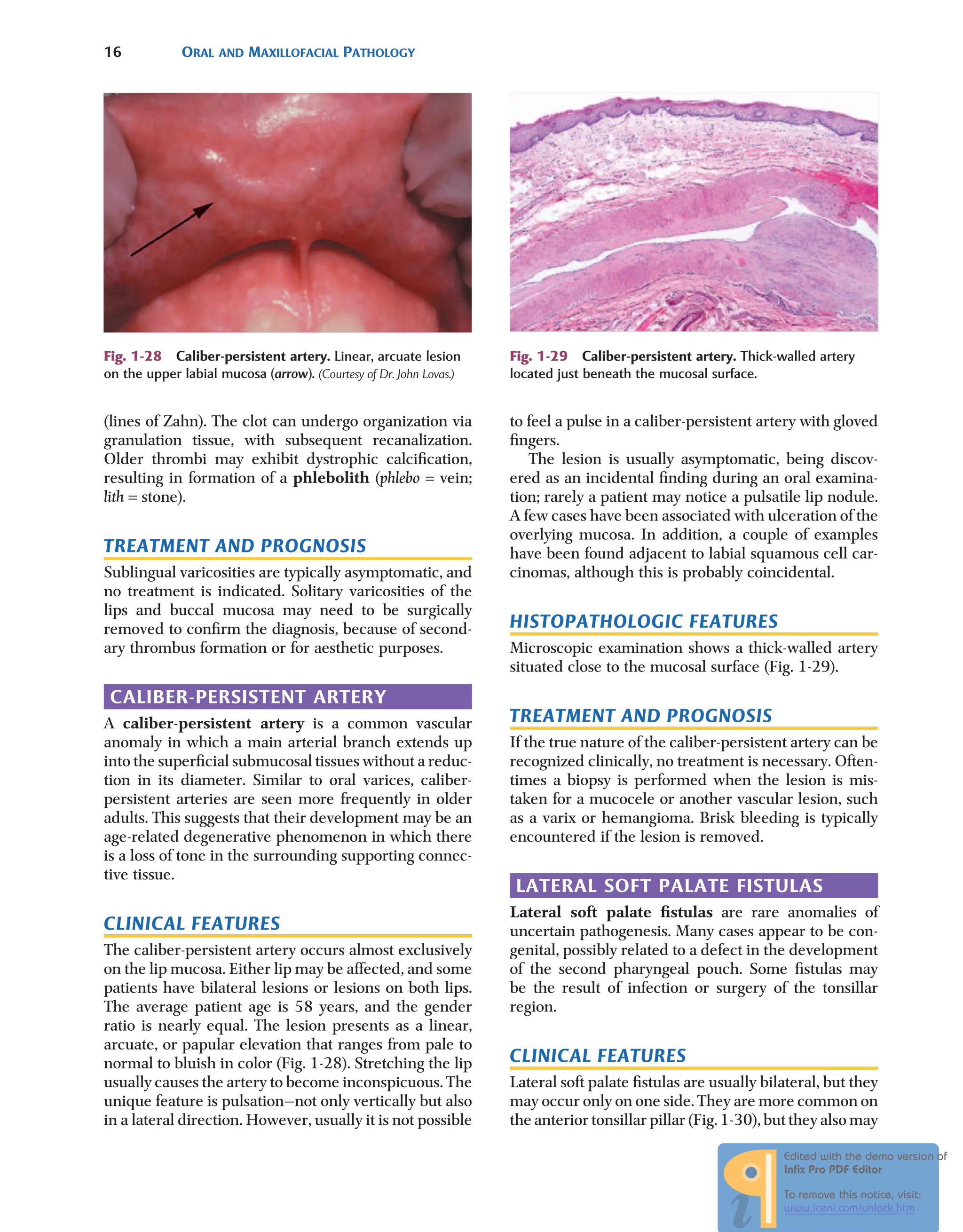 Neville, Oral and Maxillofacial Pathology, 3e.pdf