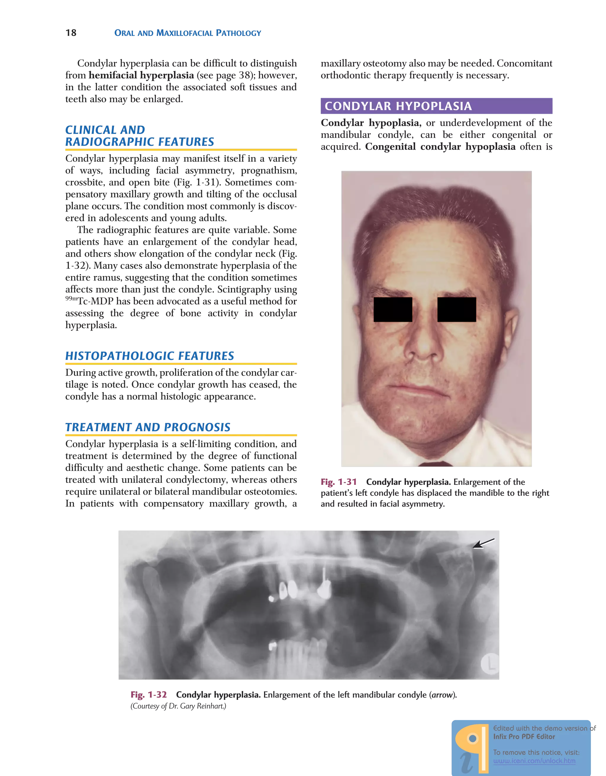 Neville, Oral and Maxillofacial Pathology, 3e.pdf