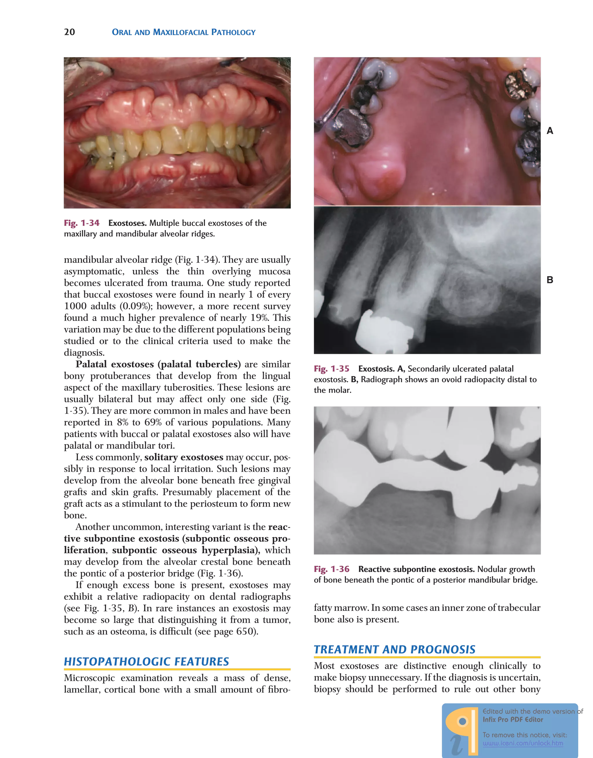 Neville, Oral and Maxillofacial Pathology, 3e.pdf