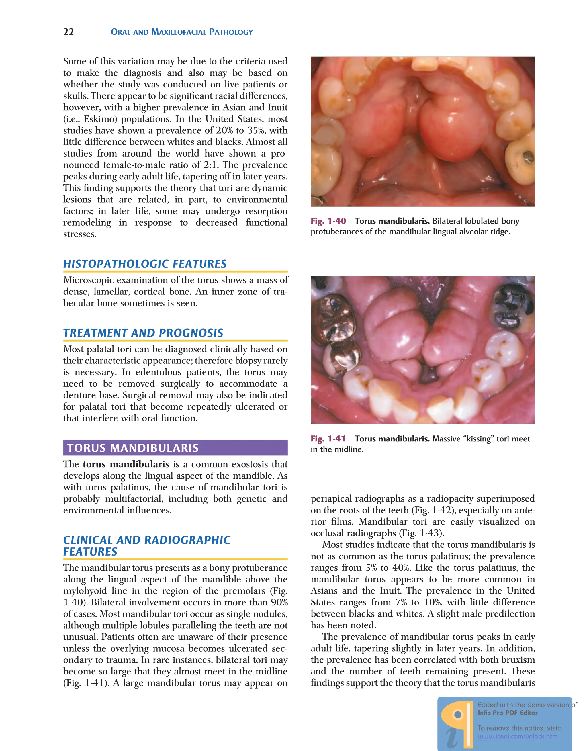 Neville, Oral and Maxillofacial Pathology, 3e.pdf