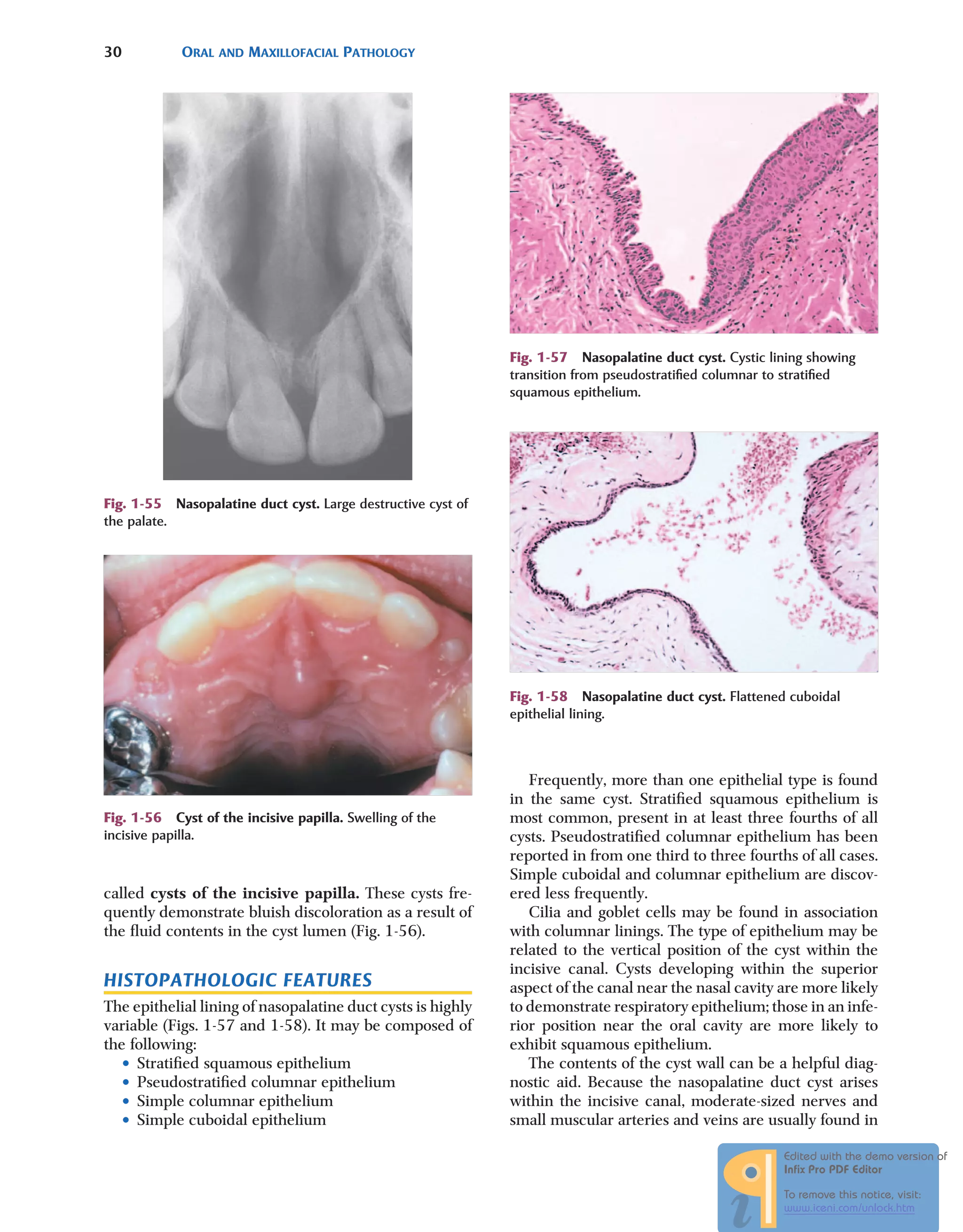 Neville, Oral and Maxillofacial Pathology, 3e.pdf