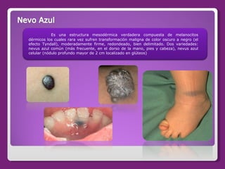 Nevo Celular Pigmentado | PPT