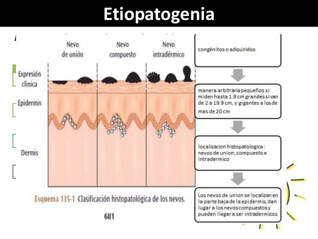 Nevos melanociticos