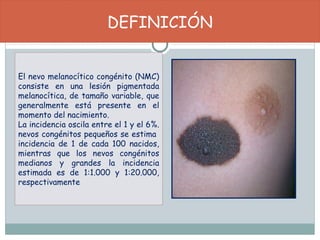 Nevus melanocitico congenito, diagnostico y tratamiento | PPT