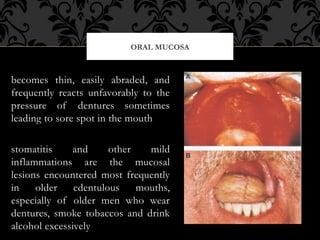 Problems associated with denture wearing and problems associated with ...