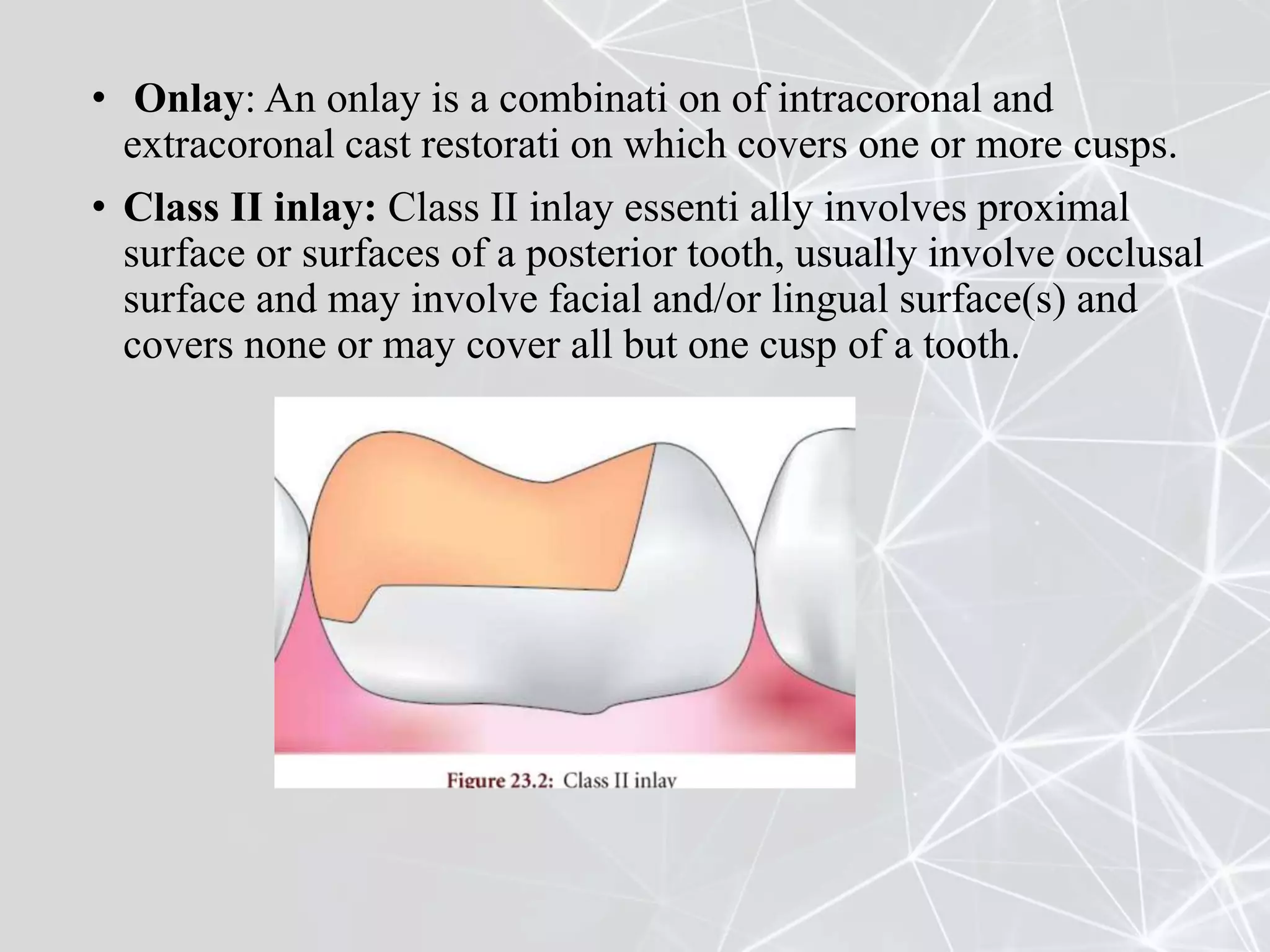 Indirect composite restorations | PPTX